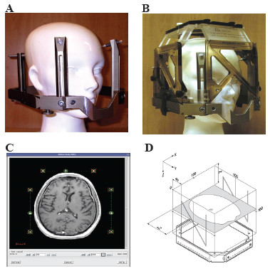 Leksell gamma knife past, present and future | proLékaře.cz