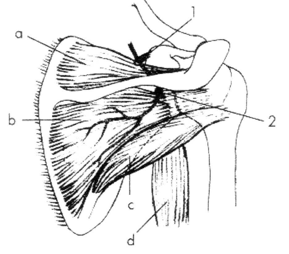 Kompresivní syndromy n. suprascapularis – zkušenosti s chirurgickou ...