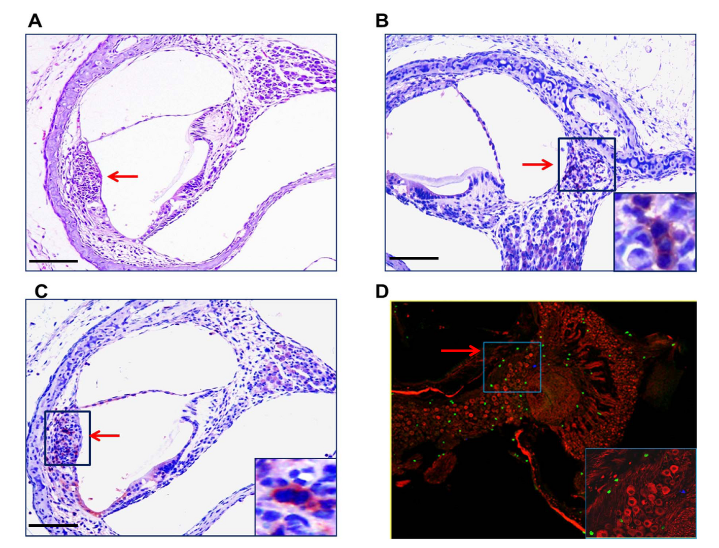 Murine CMV-Induced Hearing Loss Is Associated with Inner Ear ...