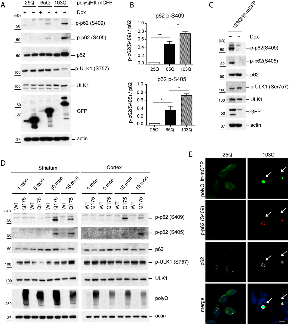 Proteotoxic Stress Induces Phosphorylation Of P62 Sqstm1 By Ulk1 To